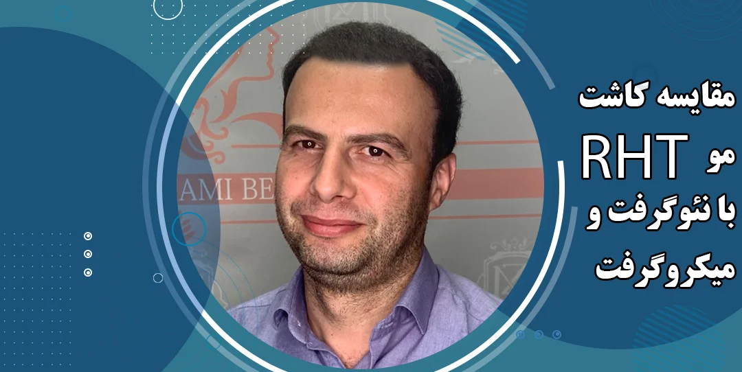 مقایسه کاشت مو RHT با نئوگرافت و میکروگرافت | کلینیک مو و ابرو ماه زر